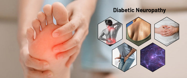 Diabetic Neuropathy Types, Causes, Symptoms, Treatment, Prevention ...